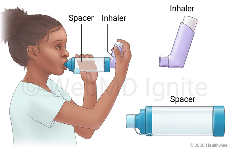 Healthwise Patient Education – Eleanor Bailey Illustration